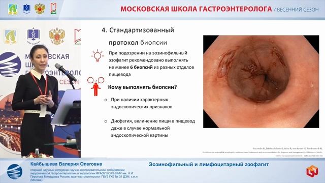 Кайбышева Валерия Олеговна Эозинофильный и лимфоцитарный эзофагит