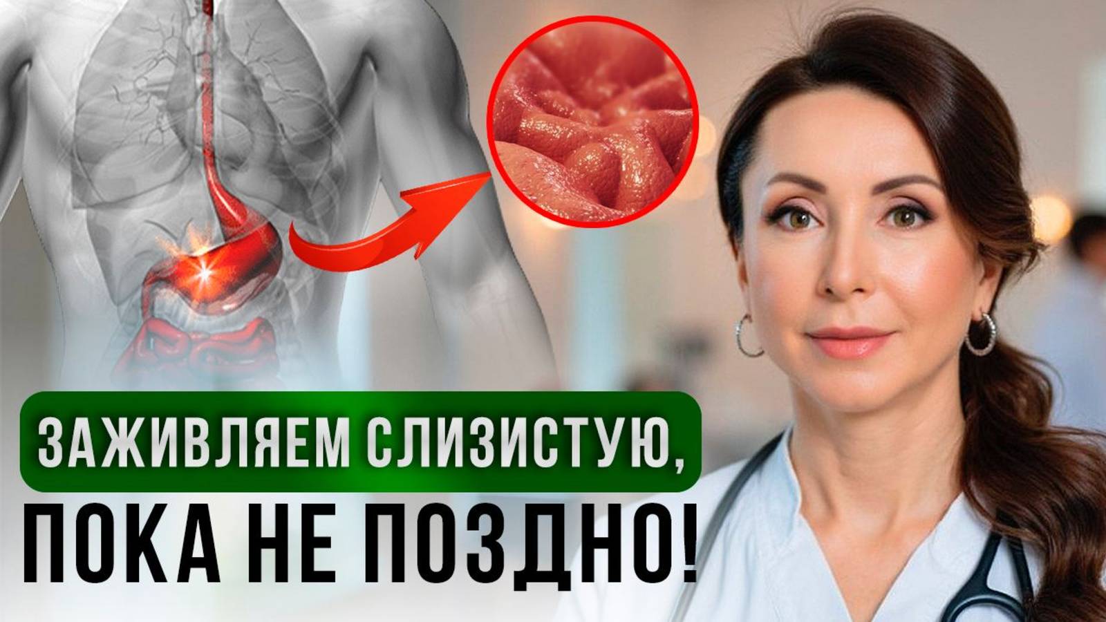 5 простых шагов ЛЕЧЕНИЯ ГАСТРИТА. Симптомы и причины гастрита