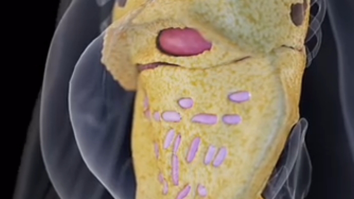 Висцеральный жир...(3D-анимация)