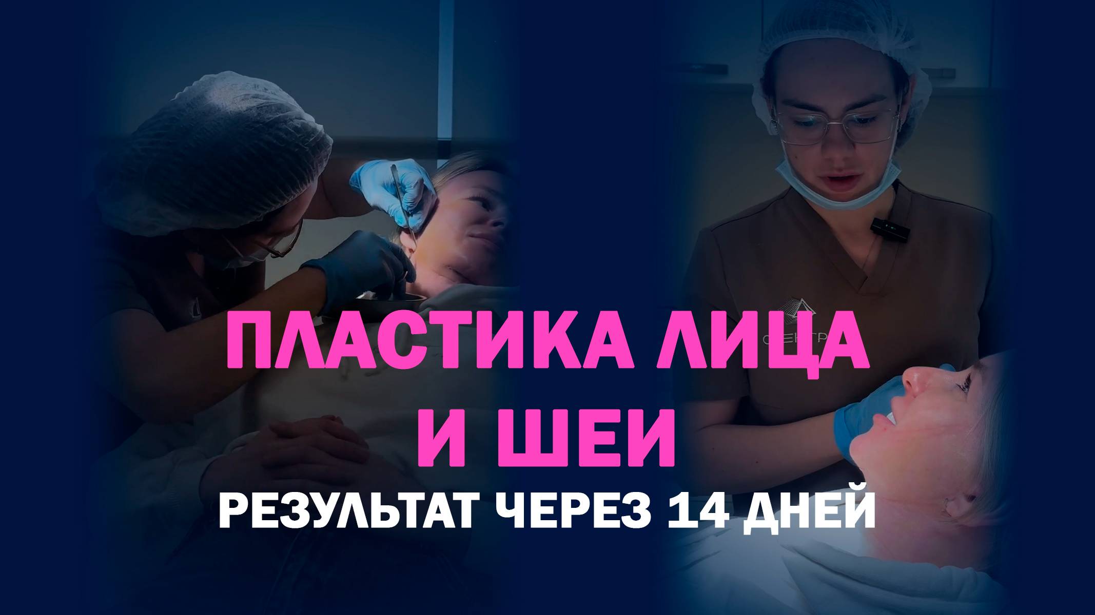 Как проходит восстановление после SMAS-подтяжки: 2 недели спустя