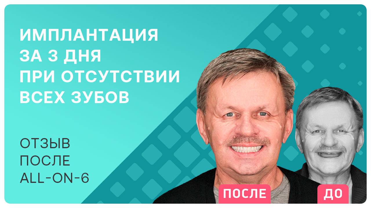 Что делать, если нет всех зубов? Я нашел выход!