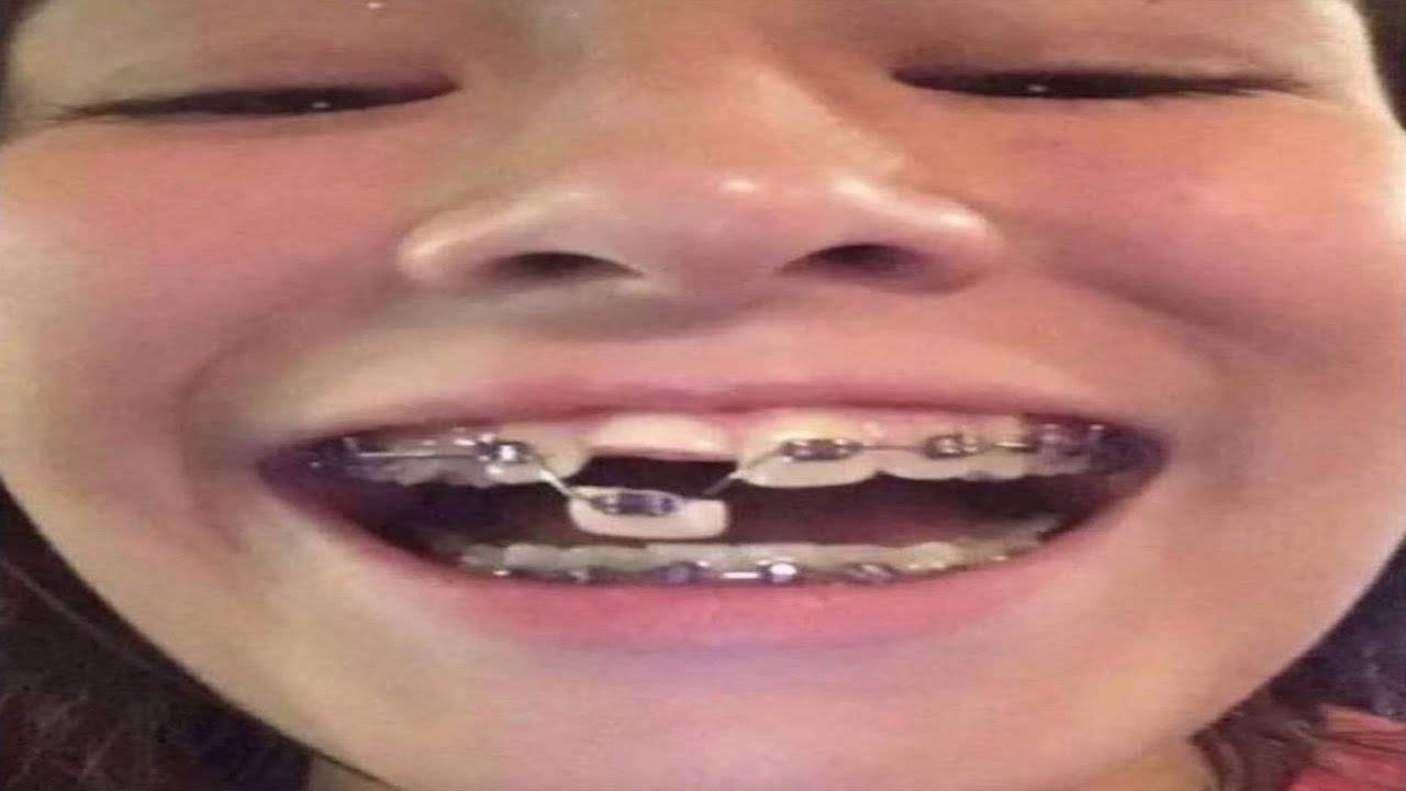 you laugh, you stop living (StreetCan)