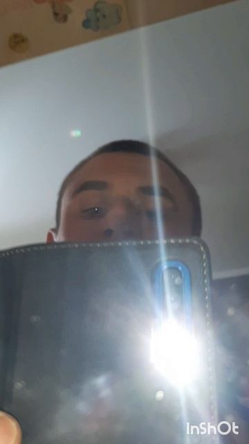 ПроЗдоровье.Операция на верхнечельстной пазухе.Фильм2.Серия1.Часть2.mp4