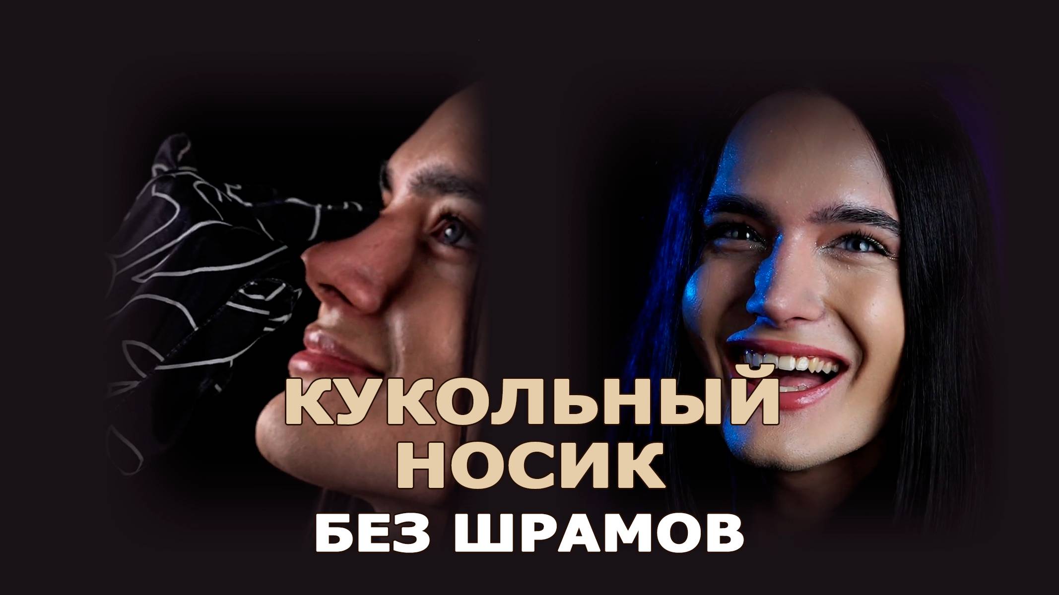 Закрытая риносептопластика: этапы, эмоции, результат по месяцам