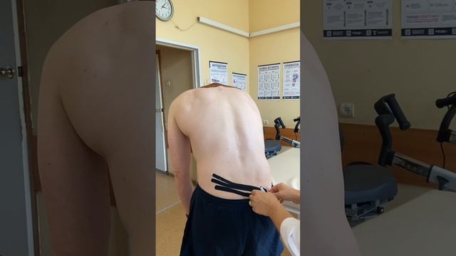 Кинезиотейпирование 3