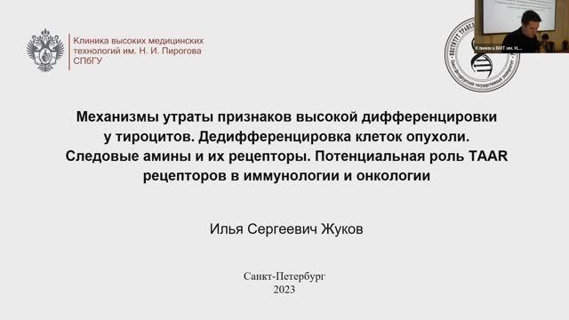 Механизмы утраты признаков высокой дифференцировки  у тироцитов. Дедифференцировка клеток опухоли.