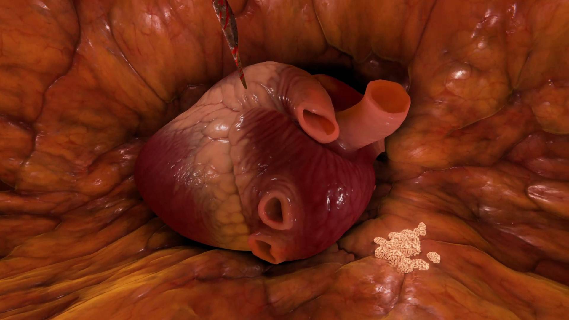 Pathologic 2 — Прохождение #13: Прививка для города