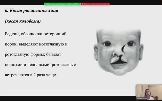 Лицо и полость рта - ход развития, аномалии и пороки