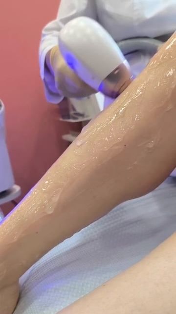 ЛАЗЕРНАЯ ЭПИЛЯЦИЯ