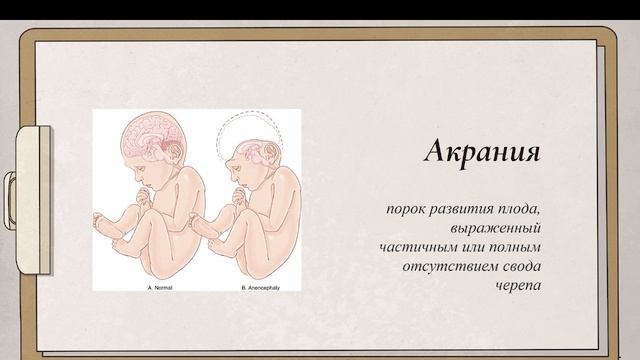Аномалии и пороки развития костей лицевого и мозгового отдела черепа