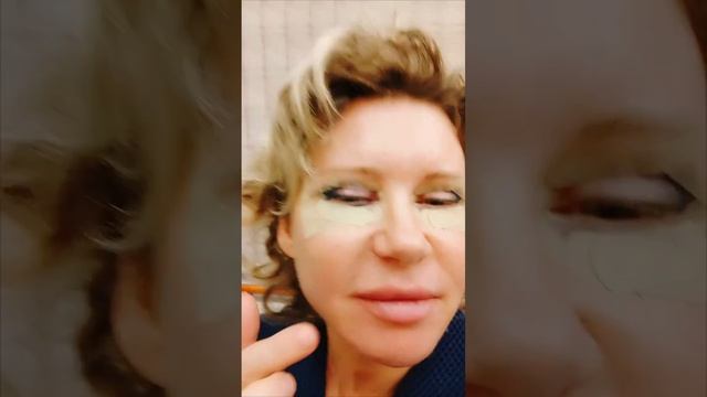 3 часа после блефаропластики. Отзыв