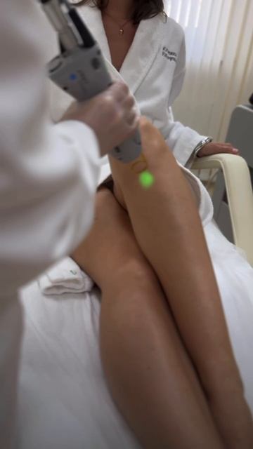 Лазерная эпиляция