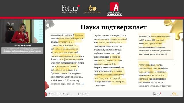 Варианты сочетания Fotona 4D омоложения с аппаратными и инъекционными методиками. Воспякова О. В.