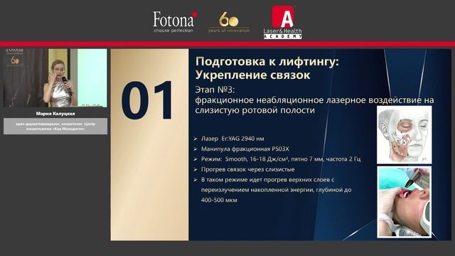 Fotona 4D и нитевой лифтинг – вместе или вместо. Методика эффективного сочетания. Калуцкая О. Ю.