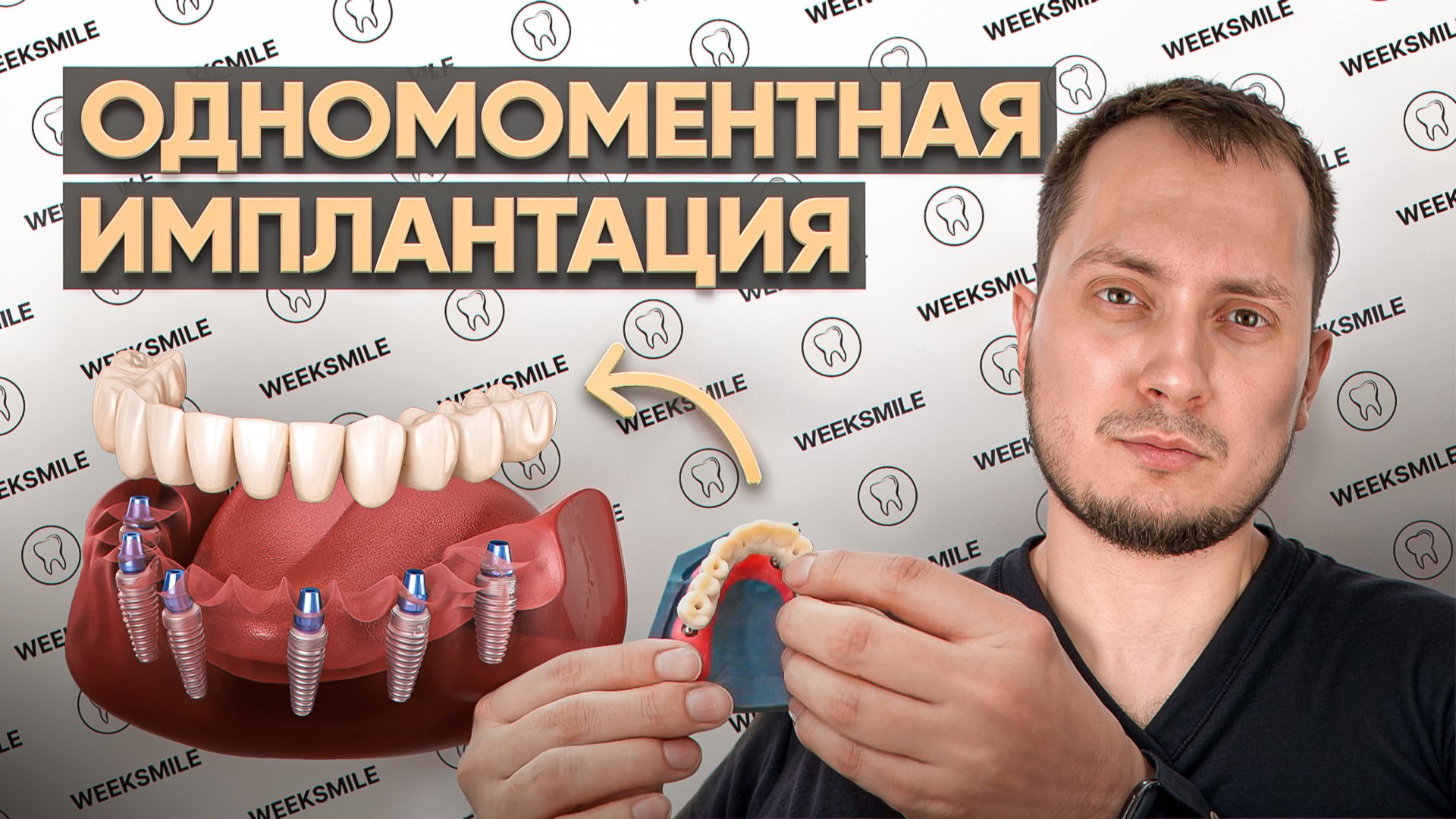 ПОДРОБНО ОБ ОДНОМОМЕНТНОЙ ИМПЛАНТАЦИИ. Больно ли устанавливать имплант? Коронка на имплант