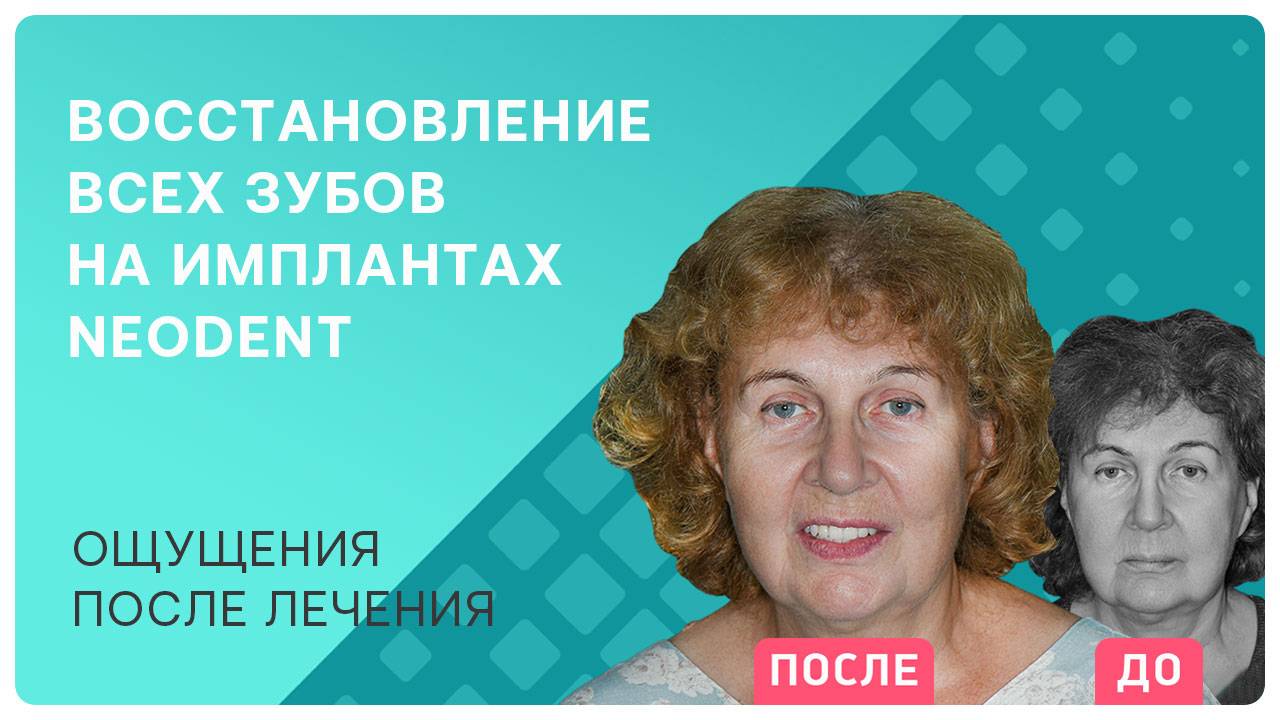 Как прошла операция по установке имплантов? Рассказываю!