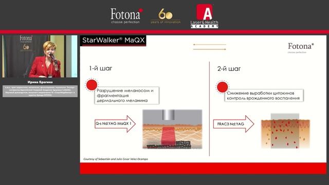 Как Fotona меняет правила игры в комплексной терапии пигментных нарушений. Брагина И. Ю.