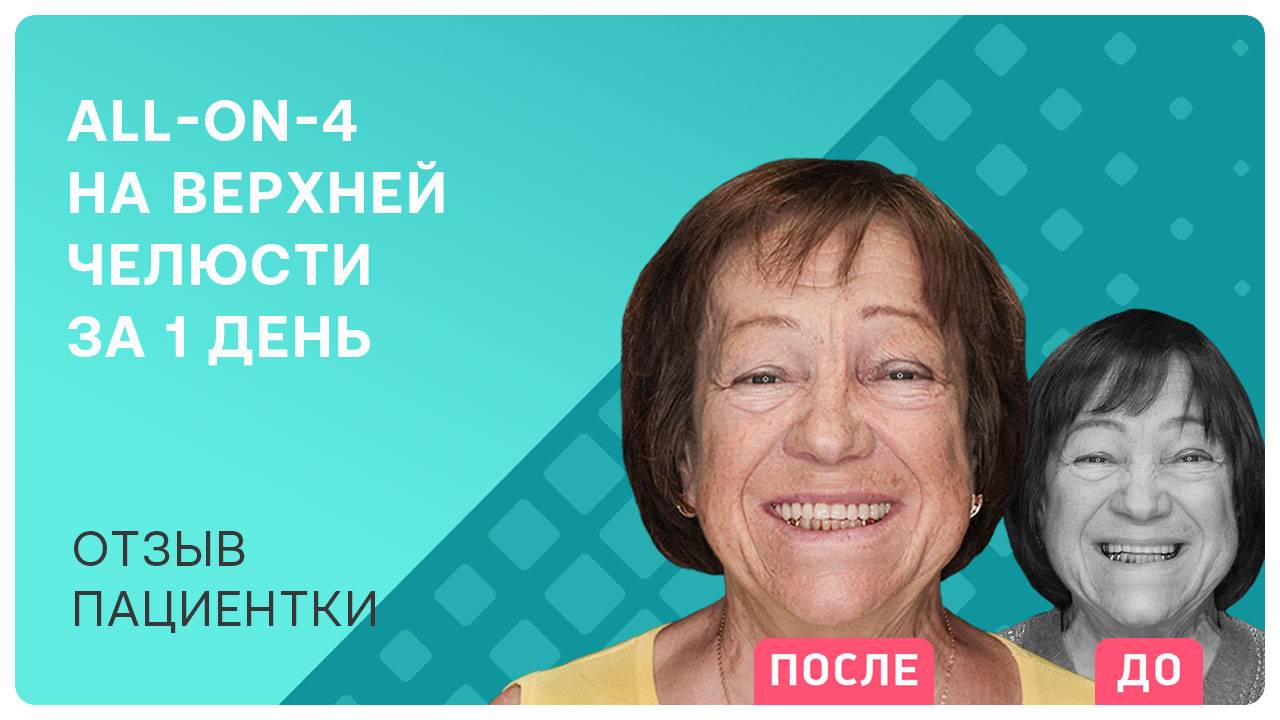 Как обрести красивую улыбку за 1 день?