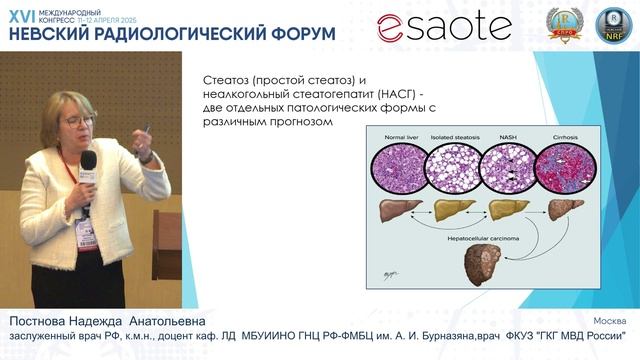 Мастер-класс компании ESAOTE "Ультразвук в гастроэнтерологии: что видим и как понимаем?