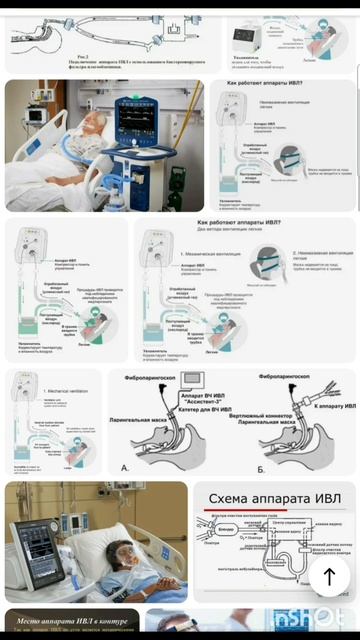ПроЗдоровье.Операция на верхнечельстной пазухе.Фильм2.Серия2.Часть6 .mp4