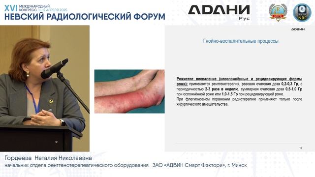 Рентгенотерапия заболеваний кожи при поддержке компании ООО «АДАНИ РУС»