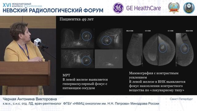 Сателлитный симпозиум «Роль методов визуализации при биопсии», при поддержке компании GE HealthCare