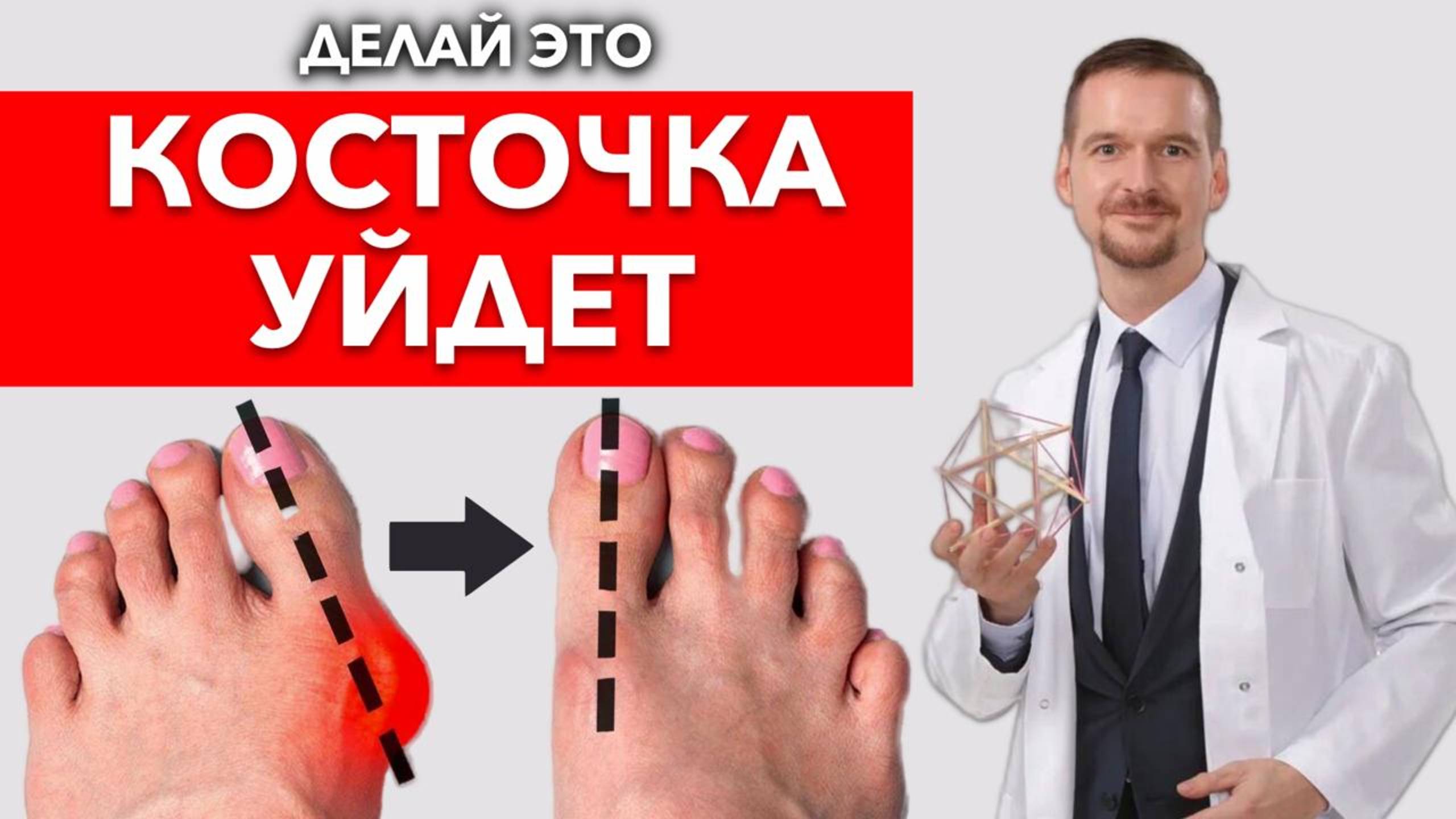 Вся правда о косточке на стопах (Hallux Valgus). 
Как избежать операции и вернуть себе здоровье.