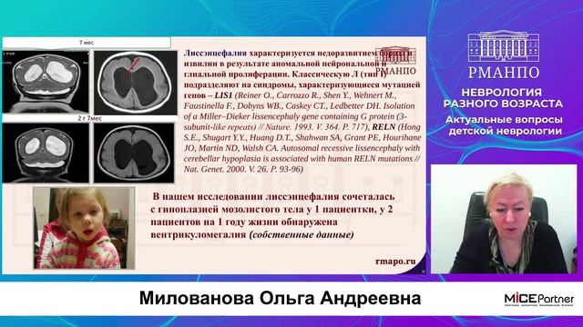 14. Милованова О.А. - Пороки головного мозга, сопровождающиеся структурной эпилепсией у детей.