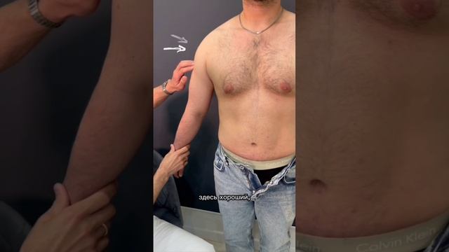 #Пластика и #высокий_ИМТ — возможно ли?