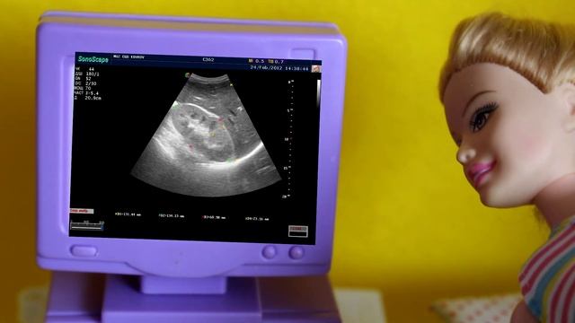 Сборник старых серий #5 Сериал Мама Барби. Няня и Ричард ждут ребенка. Тереза и Стив =❤