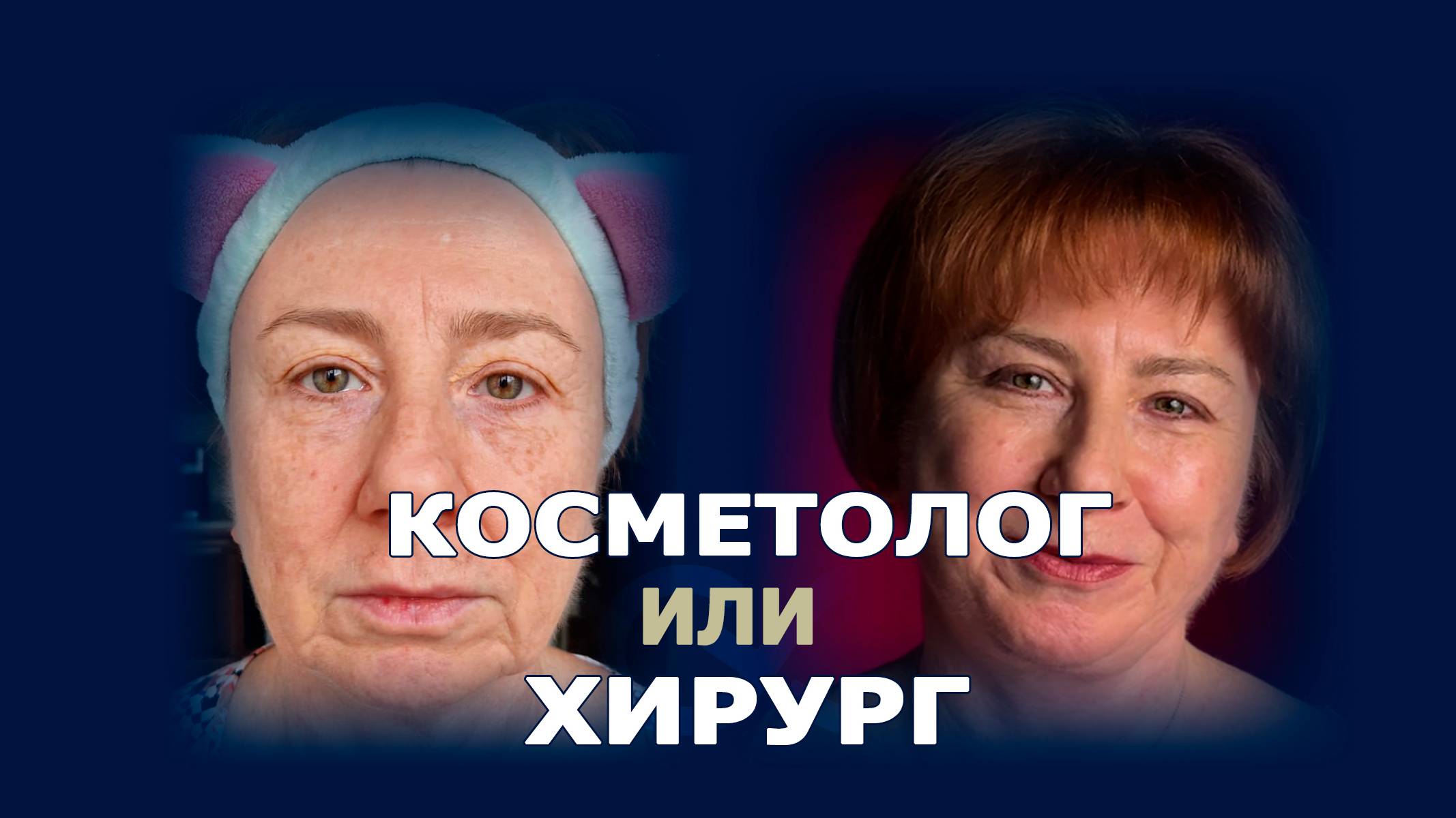 Пластика лица и шеи: эстетика без утраты естественности