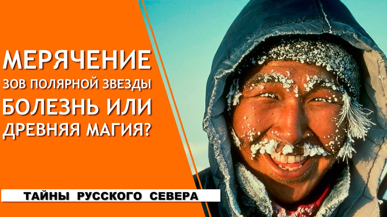 Мерячение. Зов полярной звезды. Болезнь или древняя магия?