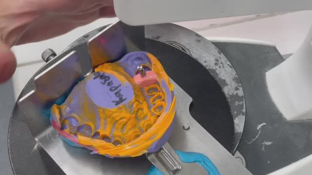 Загипсовка модели на системе Autospin