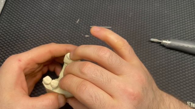 Обработка и посадка анатомических коронок - практические кейсы, ч.2