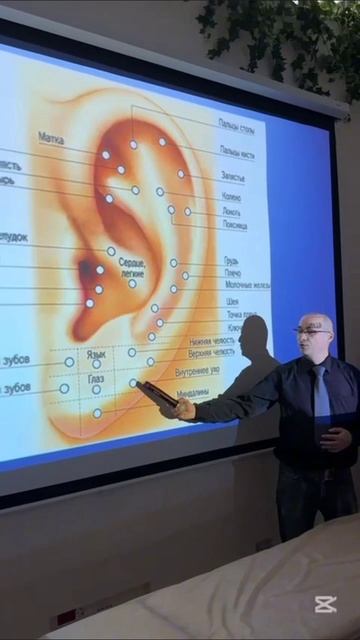 Аурикулодиагностика - учебный семинар УЦ ДПО Лауста #КацнельсонМаксим #Лауста #Диагностикапоуху