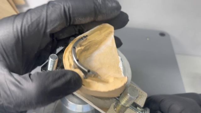 Обработка и посадка анатомических коронок - практические кейсы, ч.4