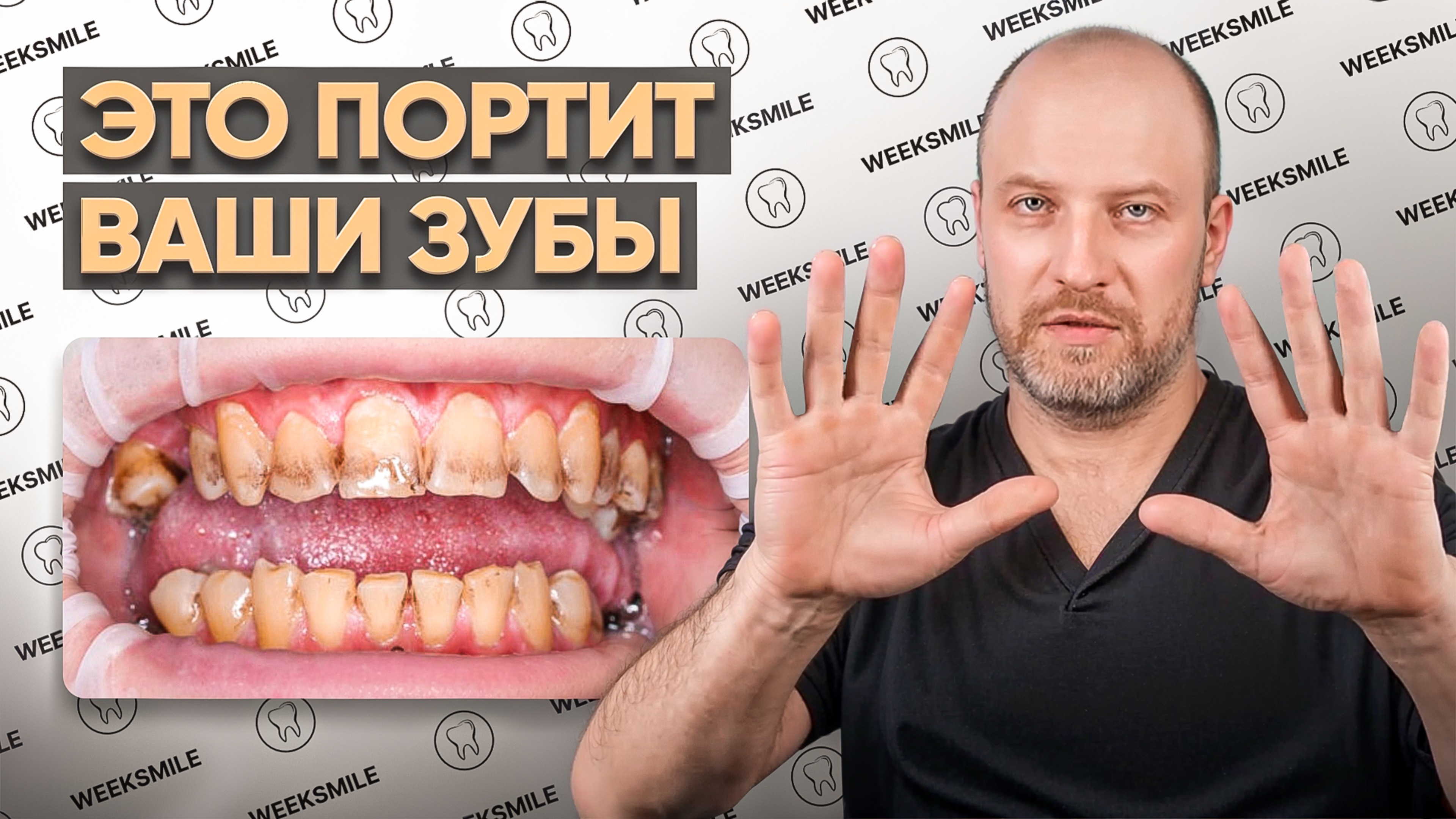 Какие продукты и привычки больше всего вредят зубам? Можно ли сладкое детям Опасность фруктов зубов