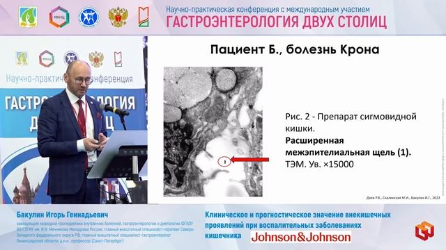 Бакулин Игорь Геннадьевич Клиническое и прогностическое значение внекишечных проявлений при воспалит