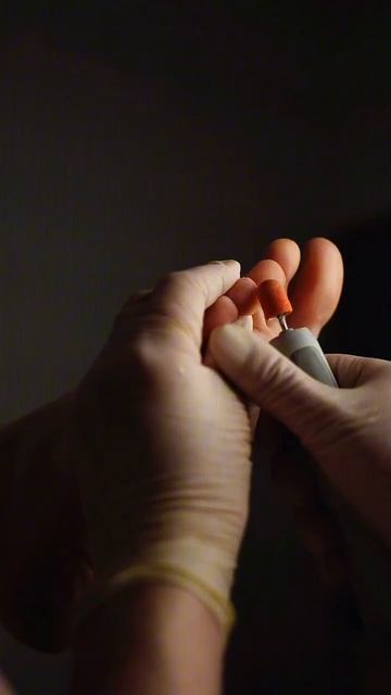 Медицинский педикюр в стиле «таймлапс», как вам? 💫