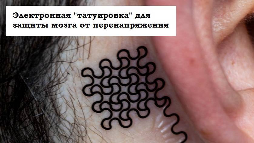 Электронная "татуировка" для защиты мозга от перенапряжения