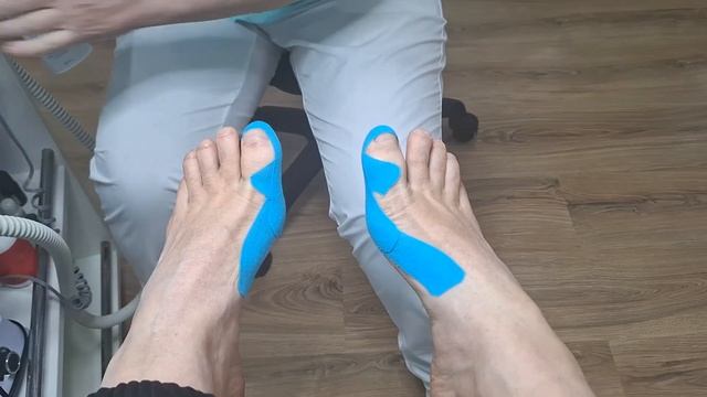 Тейпирование, как волшебная палочка при деформации  ногтя.