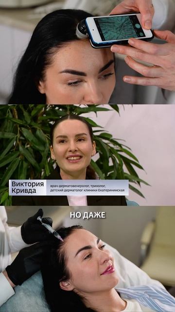 Какие способы лечения выпадения волос существуют?