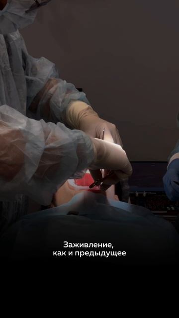 Отзыв пациента о проведении процедуры имплантации 
Врач: Александр Александрович Харин