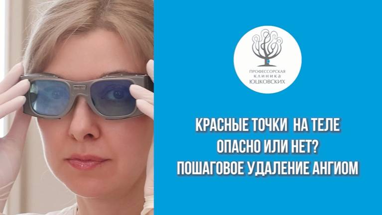 КРАСНЫЕ ТОЧКИ НА ТЕЛЕ Опасны ли ангиомы и гемангиомы? Разъясняет эксперт! #удалениеангиомы