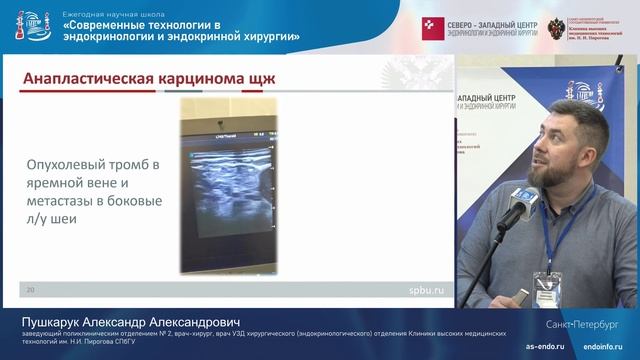 Редкие и необычные феномены при УЗИ щитовидной железы