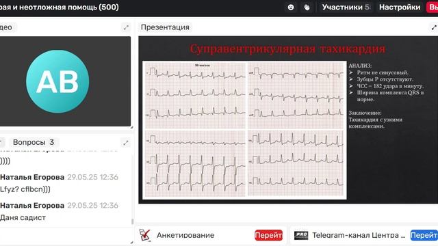 ЭКГ-2(3 часть).Зверев.avi