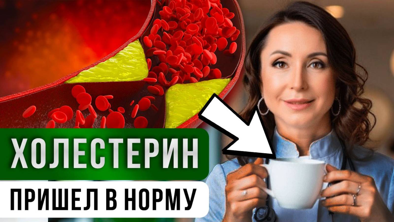 КАК снизить ХОЛЕСТЕРИН БЕЗ ТАБЛЕТОК? Избавляемся от атеросклероза!