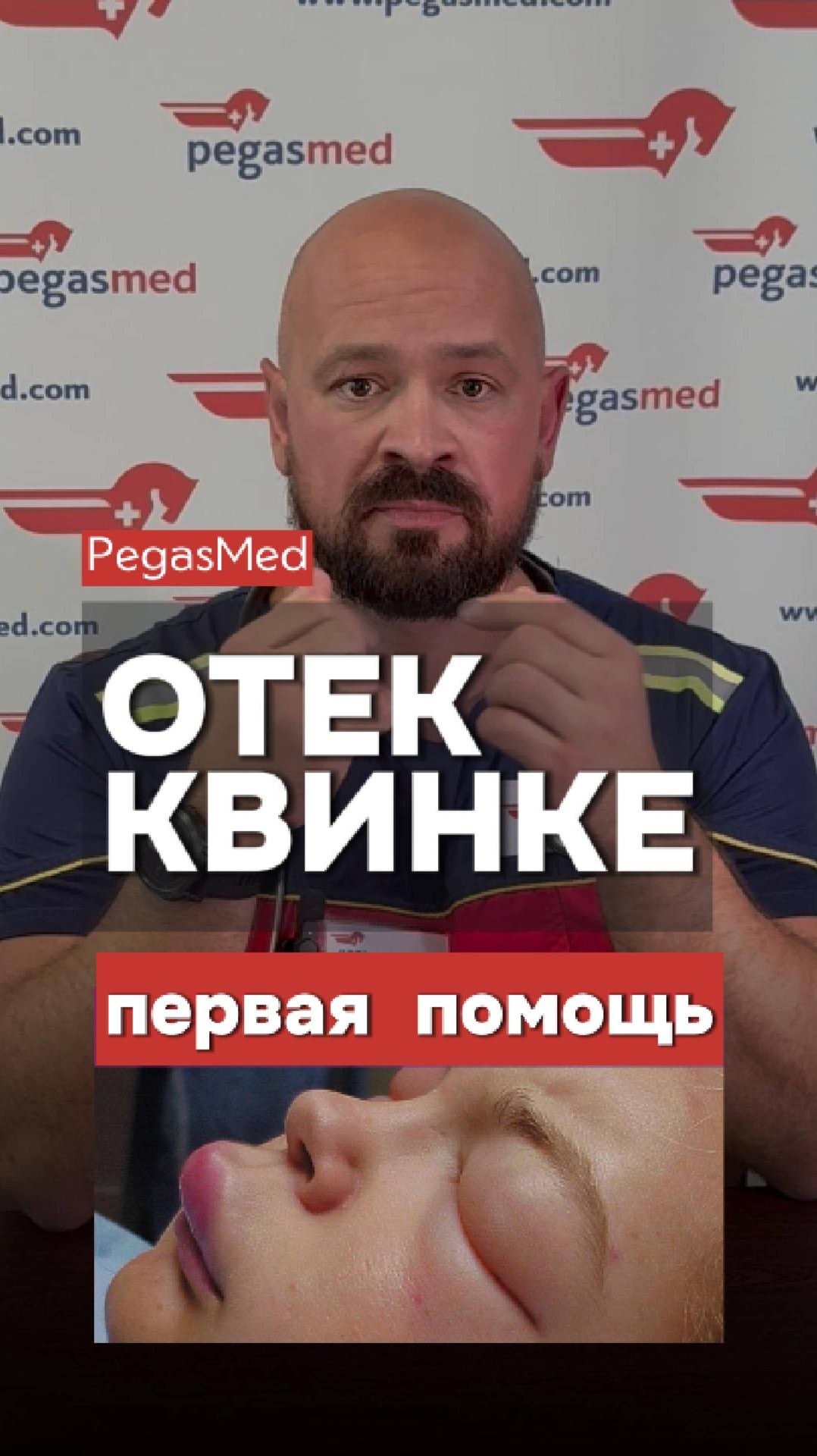 😨Отек Квинке - 💉Первая помощь, ответы на вопросы