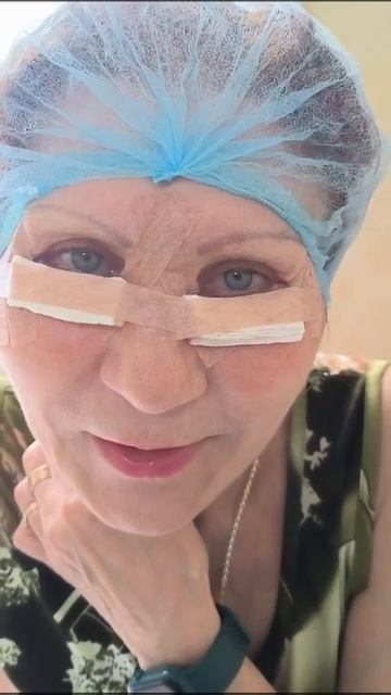 Мой результат после блефаропластики | Отзыв о враче Наташе и клинике