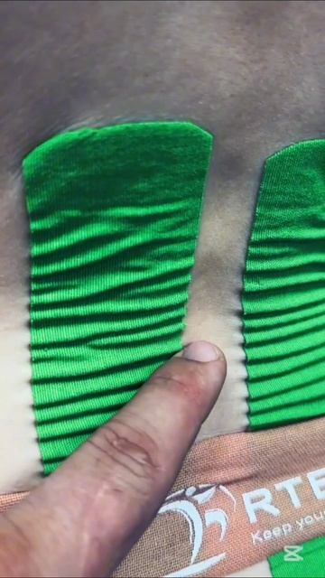 тейпирование при боли в пояснице